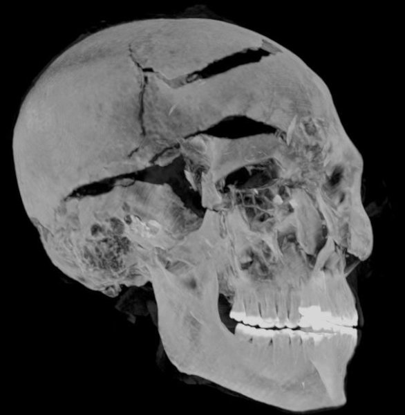 CT scan ยืนยันมัมมี่ ‘ฟาโรห์ผู้กล้า’ สิ้นพระชนม์ในสมรภูมิรบ - BT beartai