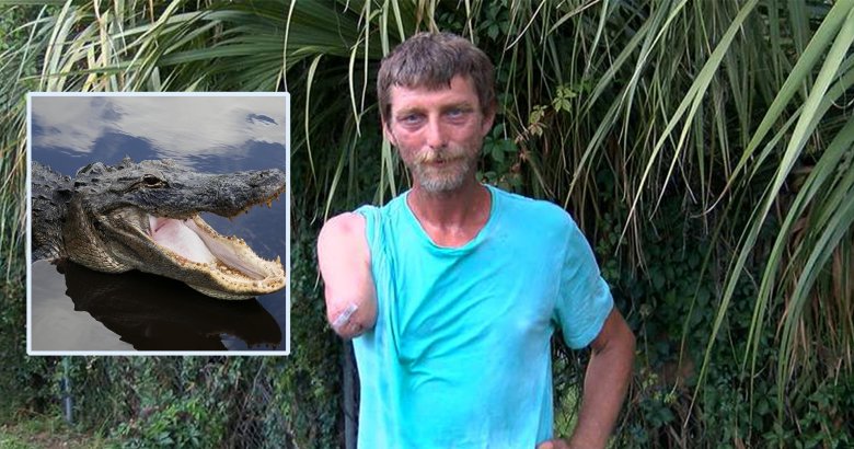 ชายฟลอริดาหลงทางในป่า โดนจระเข้กัดแขนขาด ต้องเดินต่ออีก 3 วัน กว่าจะ ...